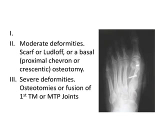 Lower limb deformities.pptx
