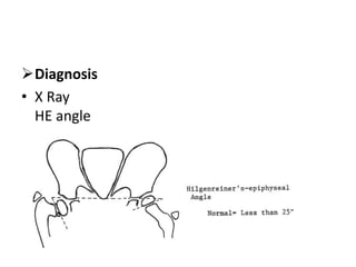 Lower limb deformities.pptx