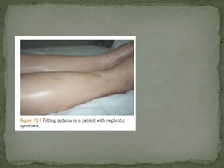 Lower limb examination.pptx