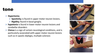 LOWER LIMB EXAMINATION.pptxThe neurologic examination is typically ...
