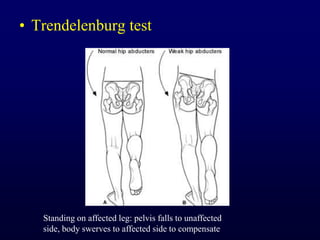 Lower limb examination undergrads | PPTX