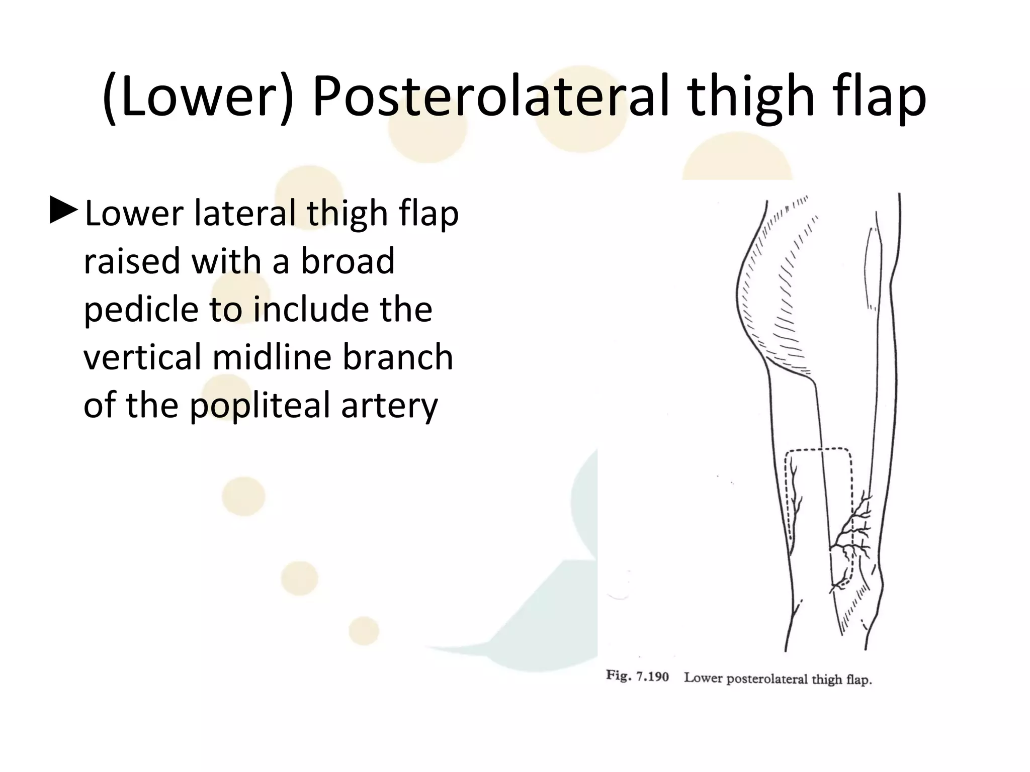 Lower limb flapsw | PPT
