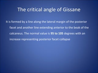 Lower limb fractures | PPT