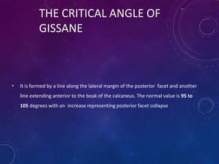 lowerlimbfractures.pptxì | PPT