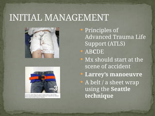 LOWER LIMB FRACTURES in adults, mva.pptx