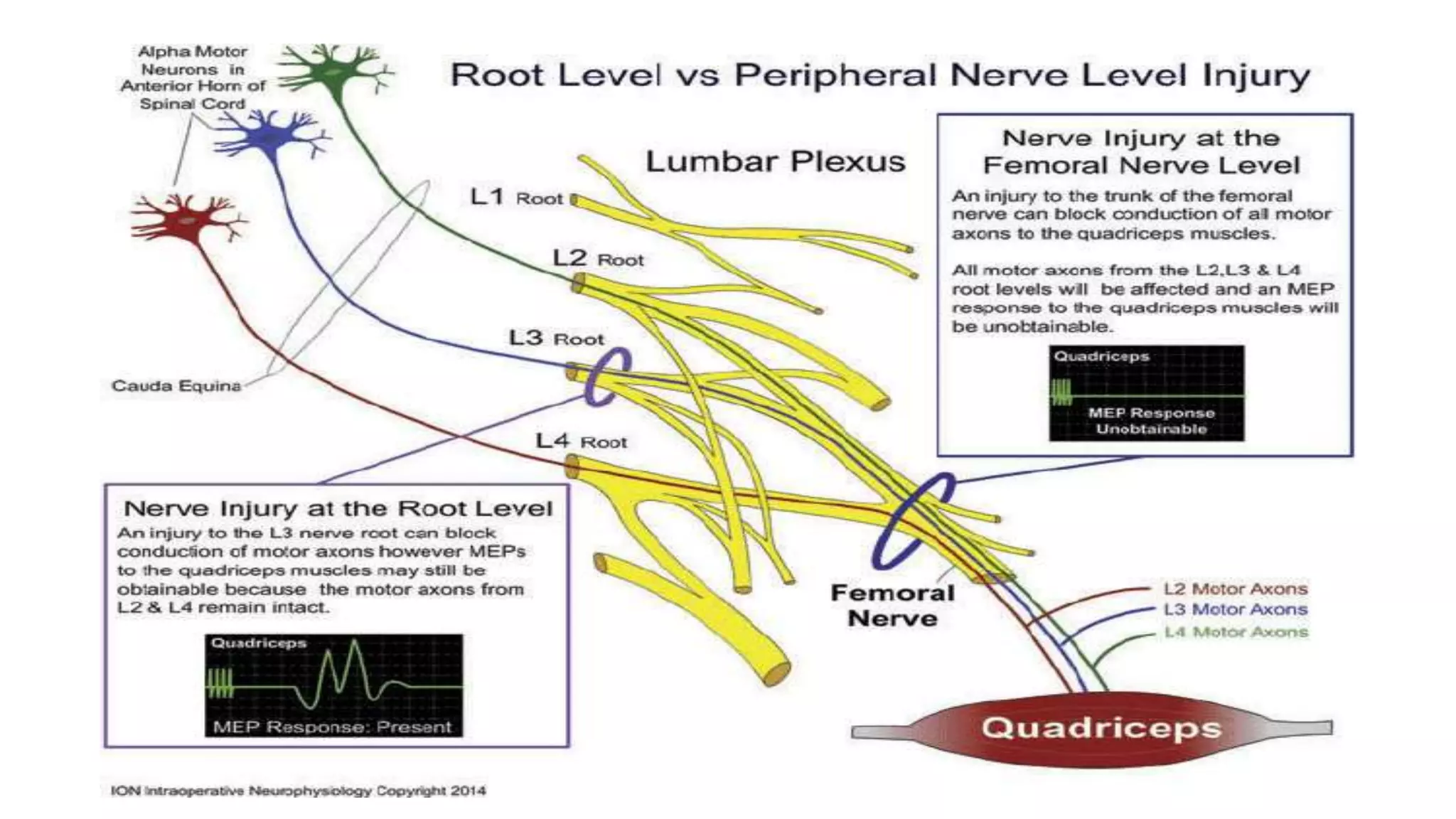 lower limb nerve injury.pptx