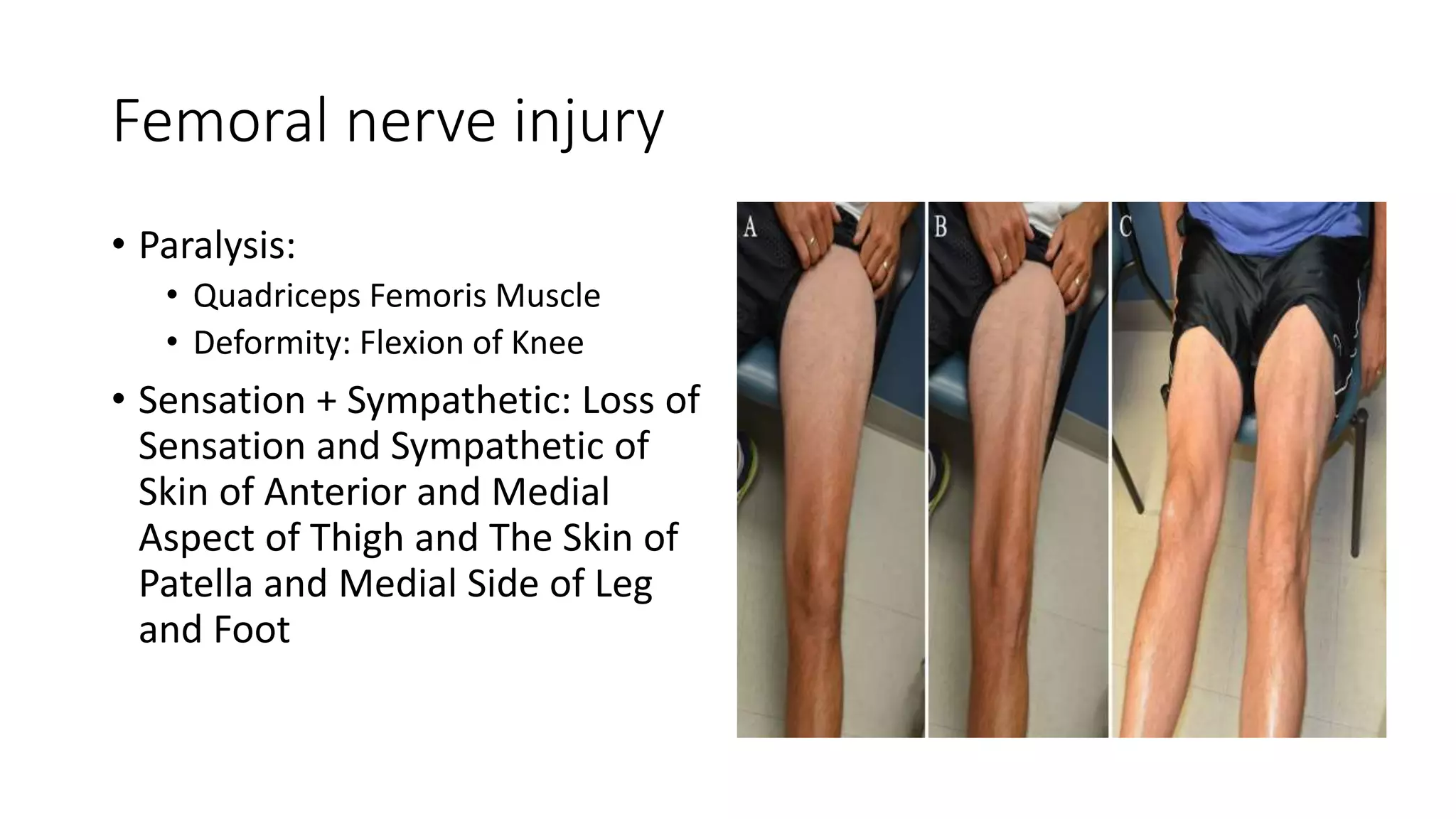 lower limb nerve injury.pptx