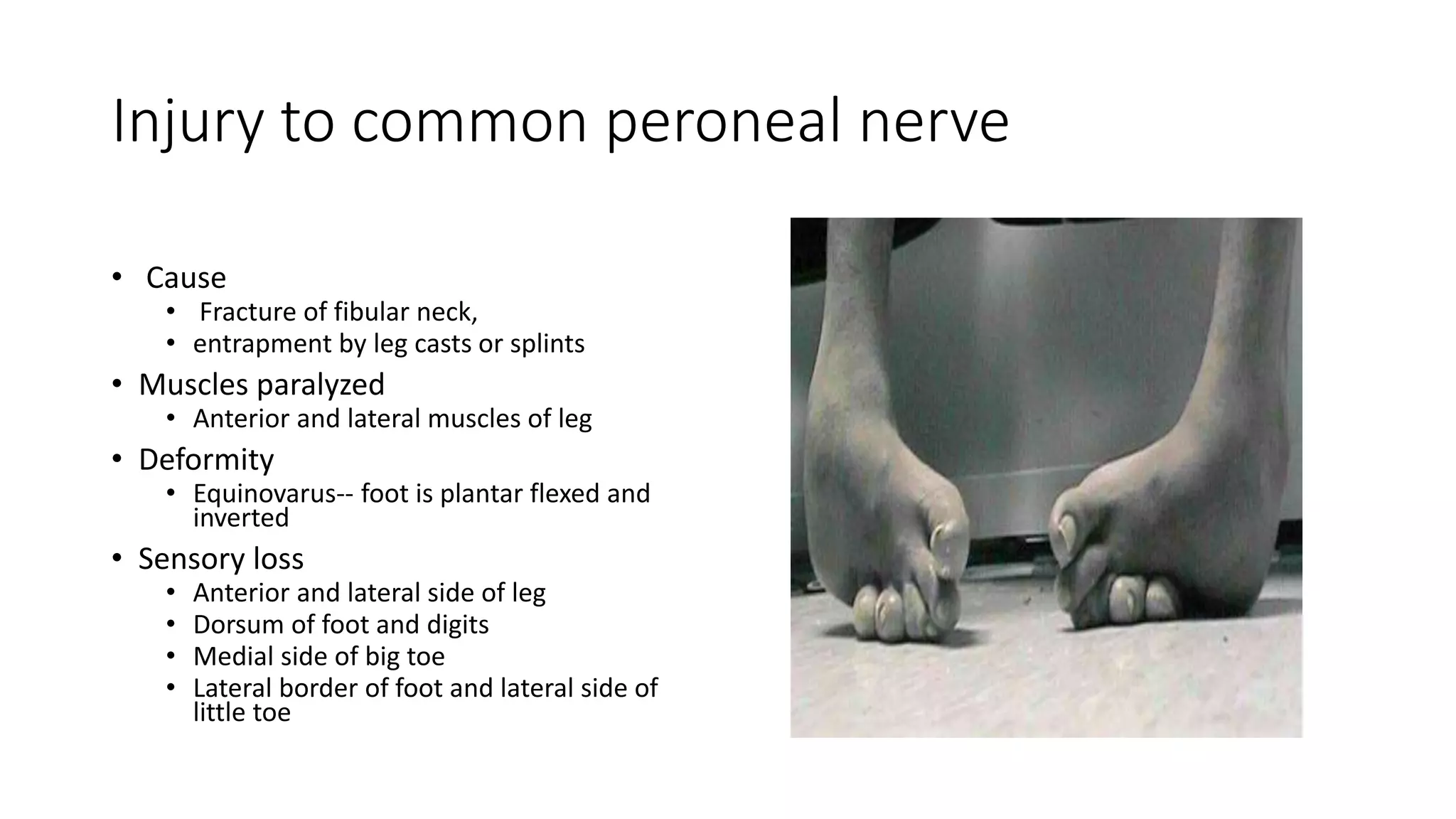 lower limb nerve injury.pptx