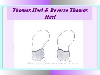 Thomas Heel Orthotic