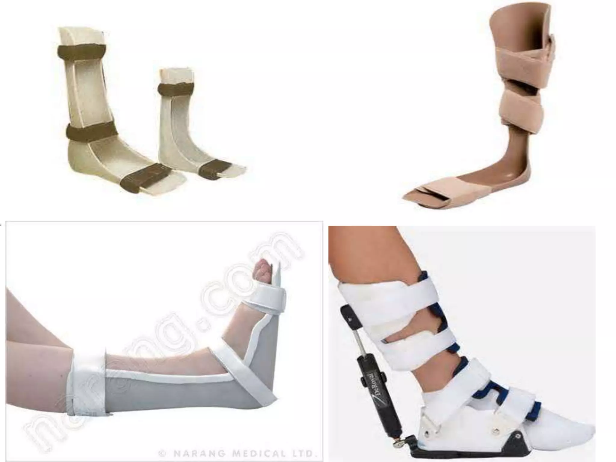 Lower limb orthosis | PPTX