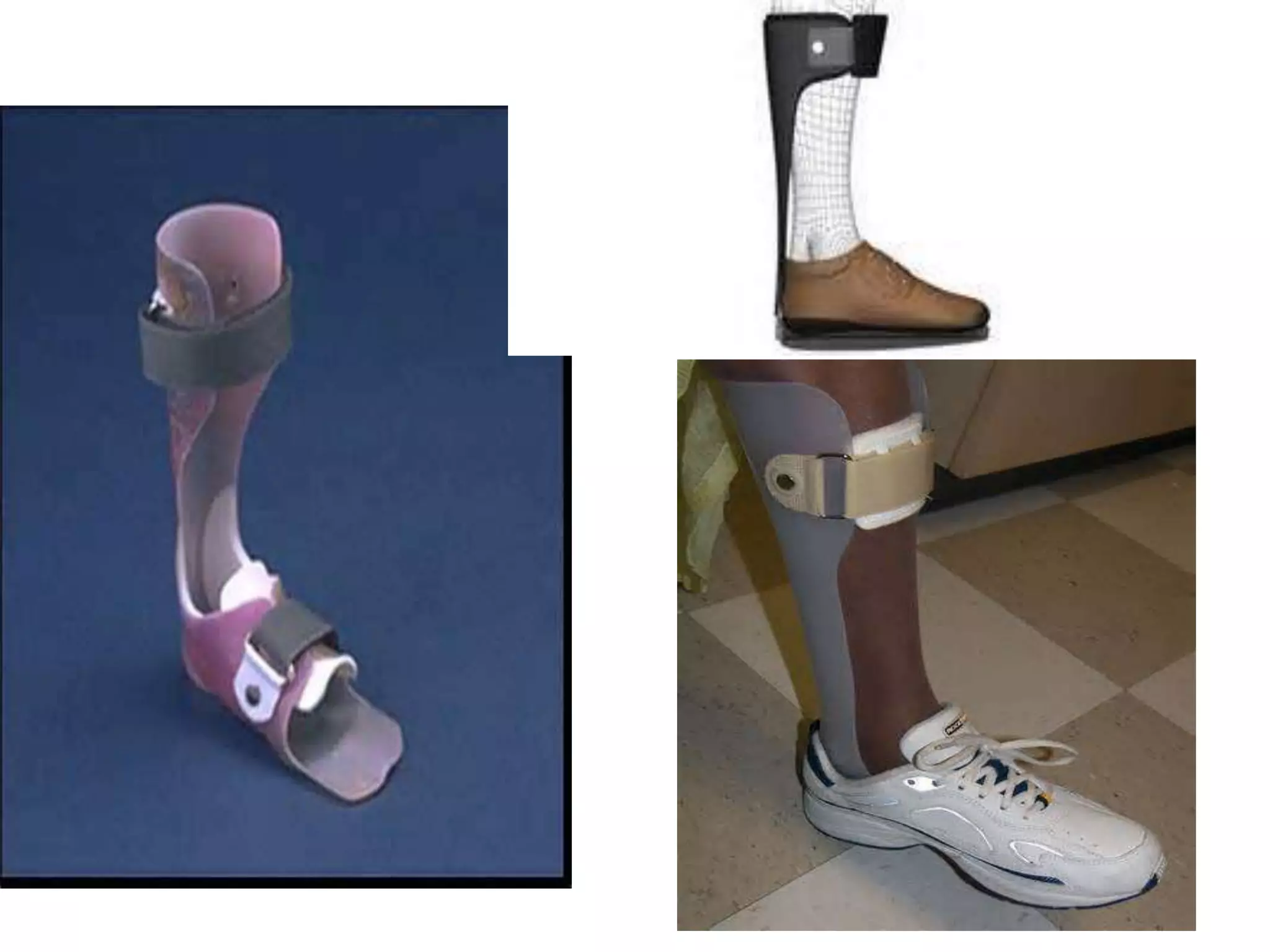 Lower limb orthosis | PPTX
