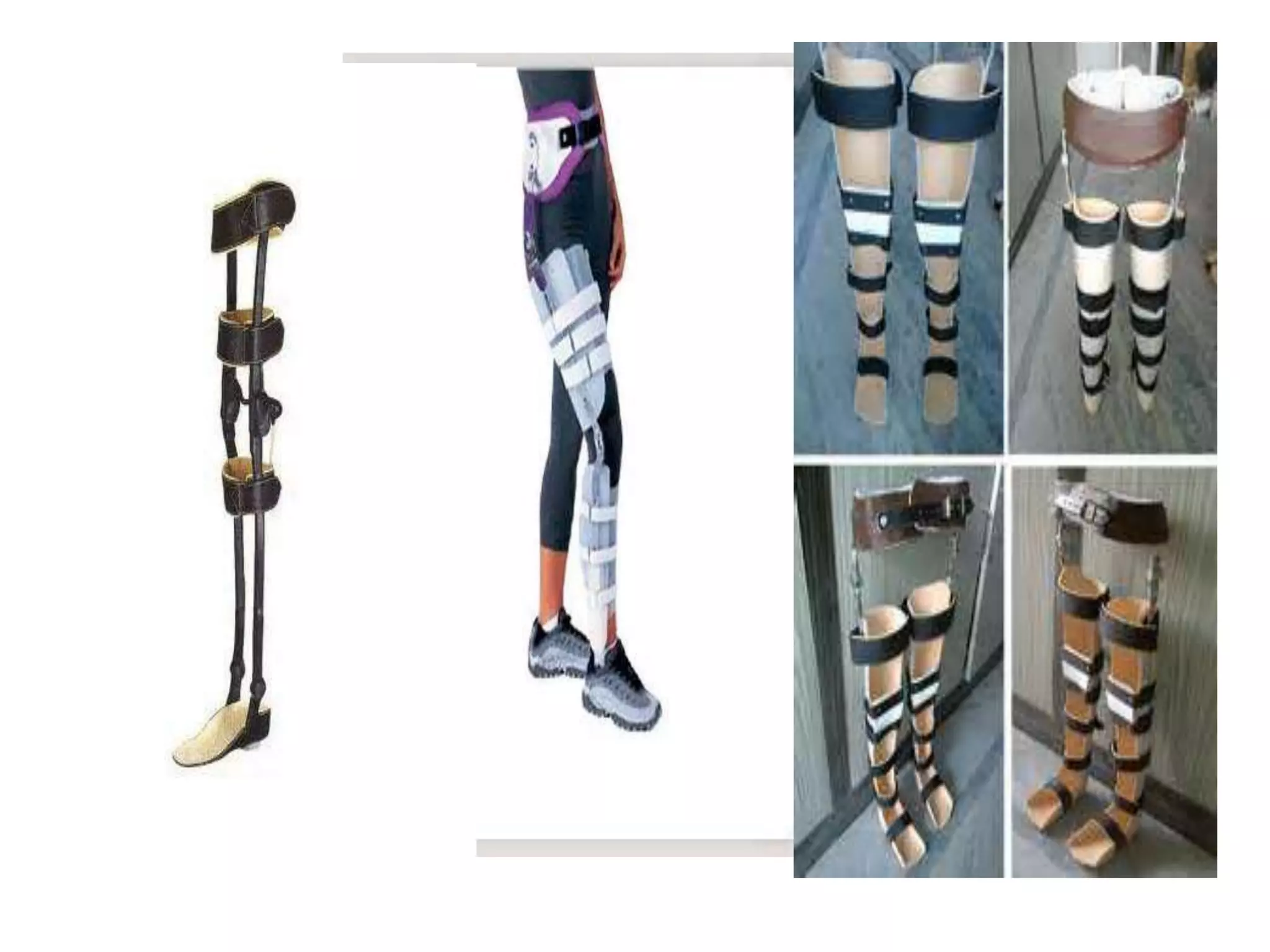 Lower limb orthosis | PPTX
