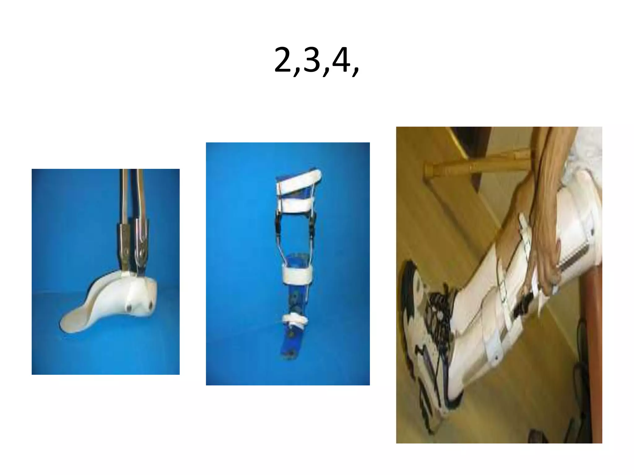 Lower limb orthosis | PPTX