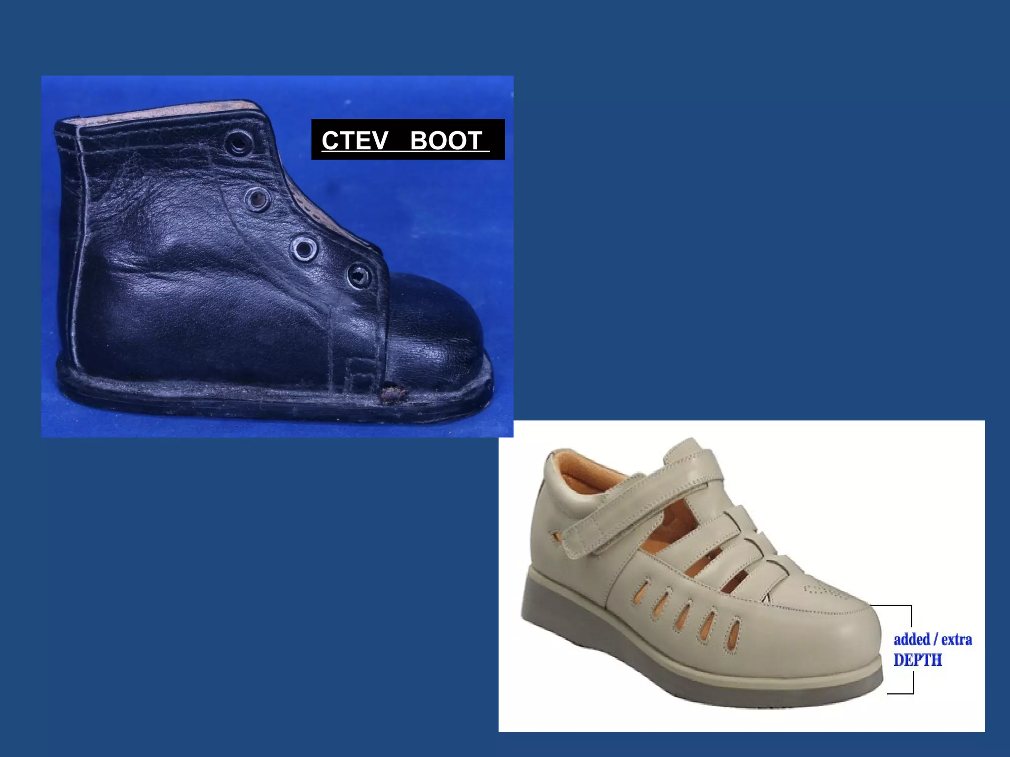 Lower Limb Orthotics - Dr Rajendra Sharma | PPT