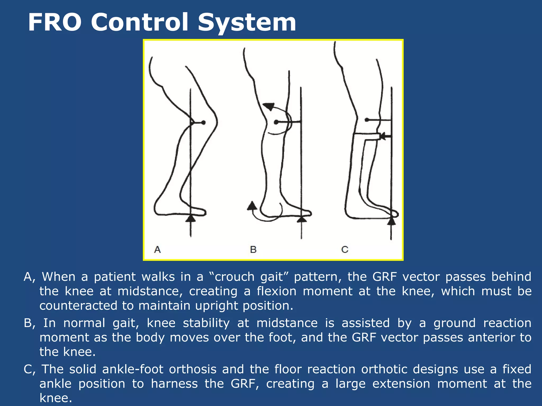 Lower Limb Orthotics - Dr Rajendra Sharma | PPT