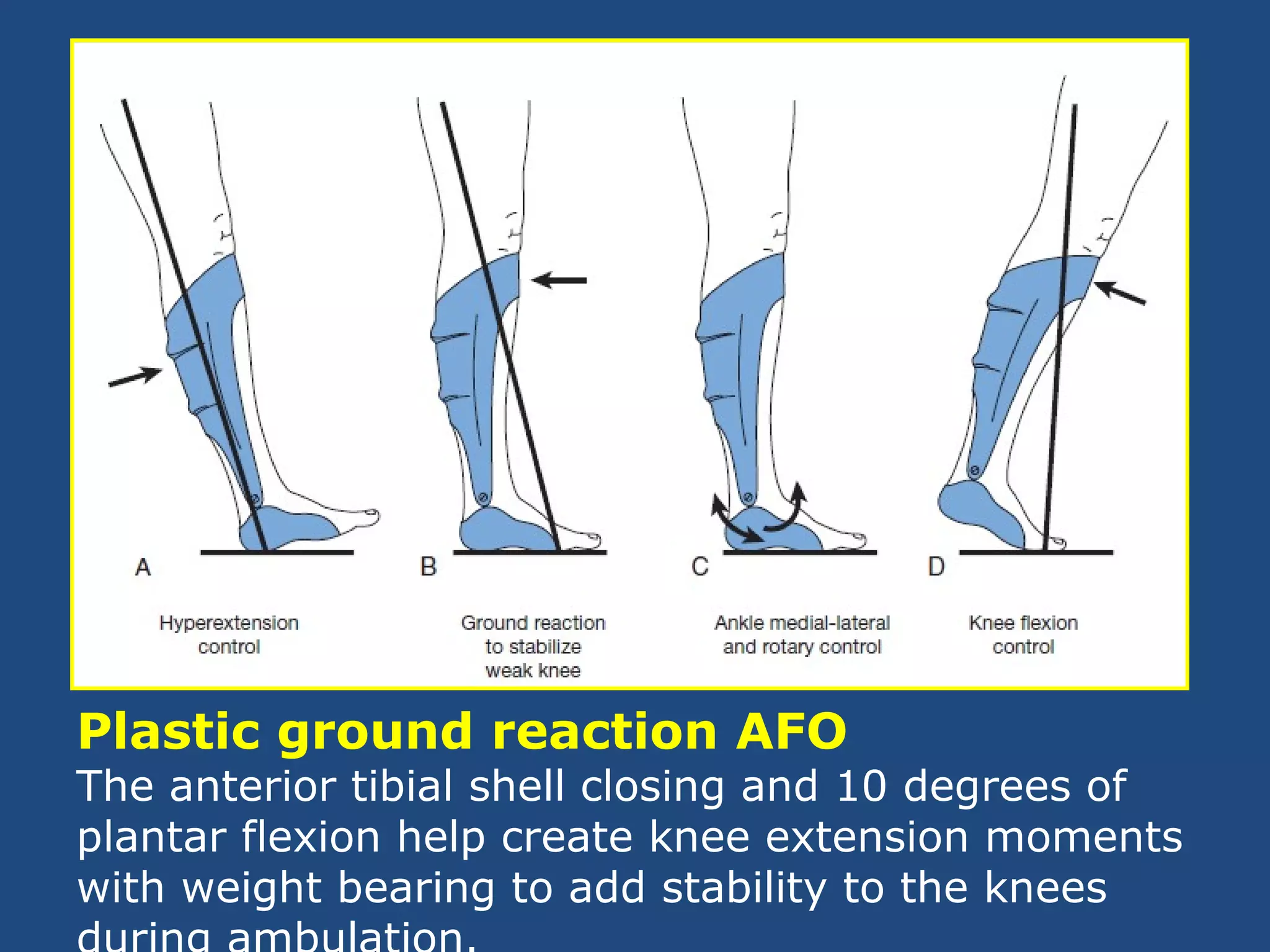 Lower Limb Orthotics - Dr Rajendra Sharma | PPT