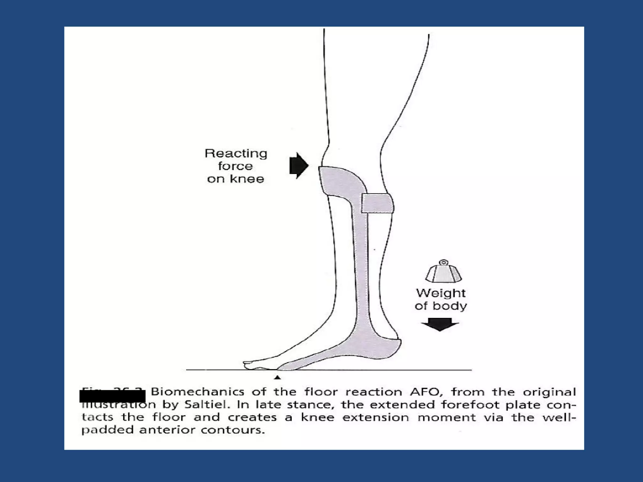 Lower Limb Orthotics - Dr Rajendra Sharma | PPT
