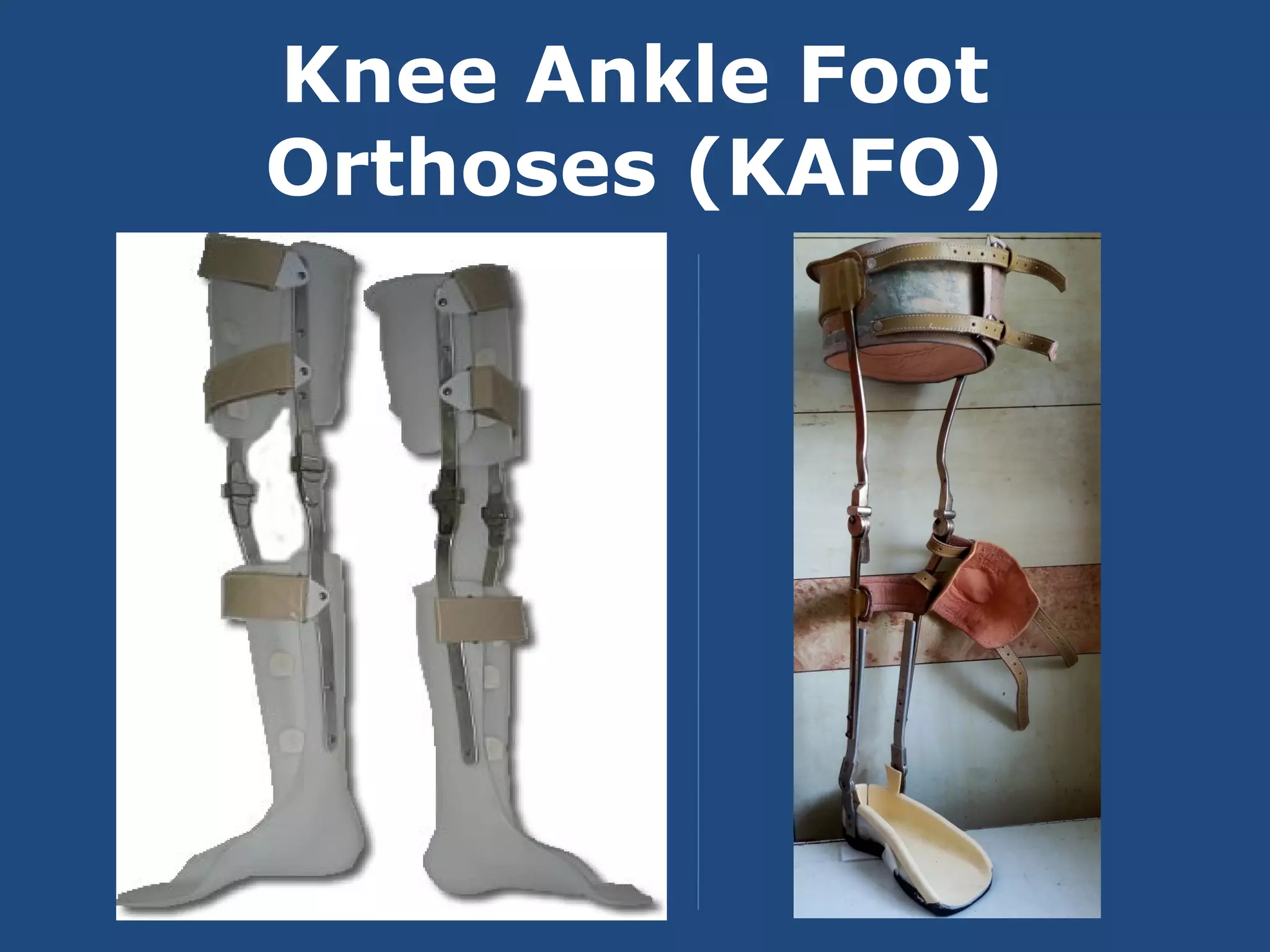 Lower Limb Orthotics - Dr Rajendra Sharma | PPT