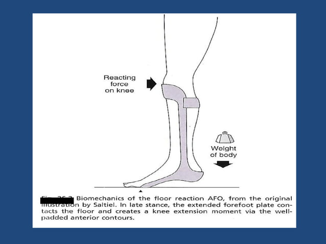 Lower Limb Orthotics - Dr Rajendra Sharma | PPT