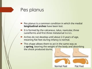 Lower limb orthosis contains foot, ankle , knee ,hip orthosis | PPTX