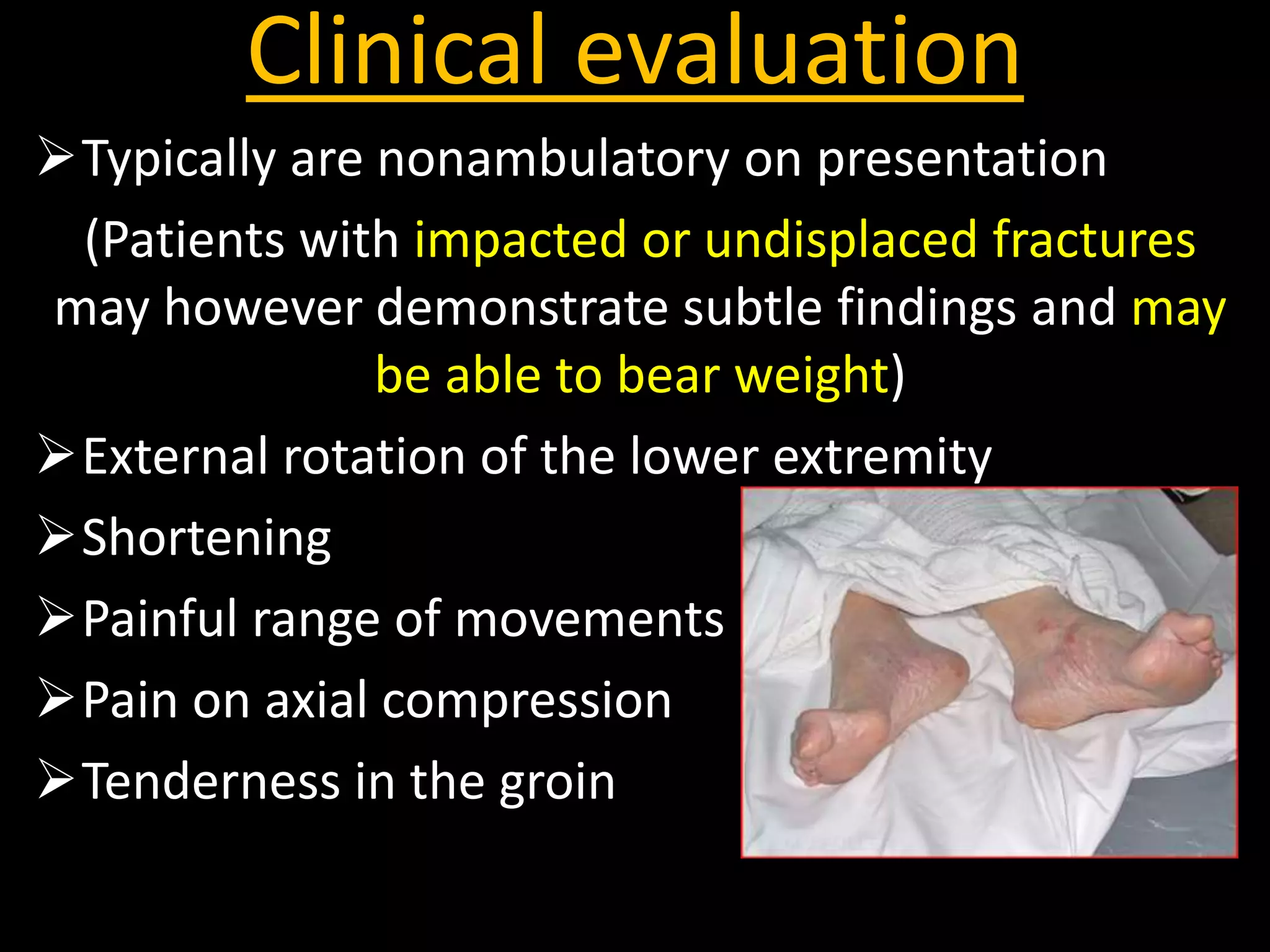 Lower limb fractures part 1 (for UGs) | PPTX