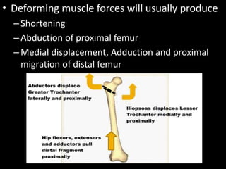 Lower limb fractures part 1 (for UGs) | PPTX