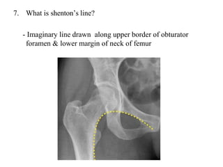 lower limb PBL ppt it expalin about the lower question | PPTX