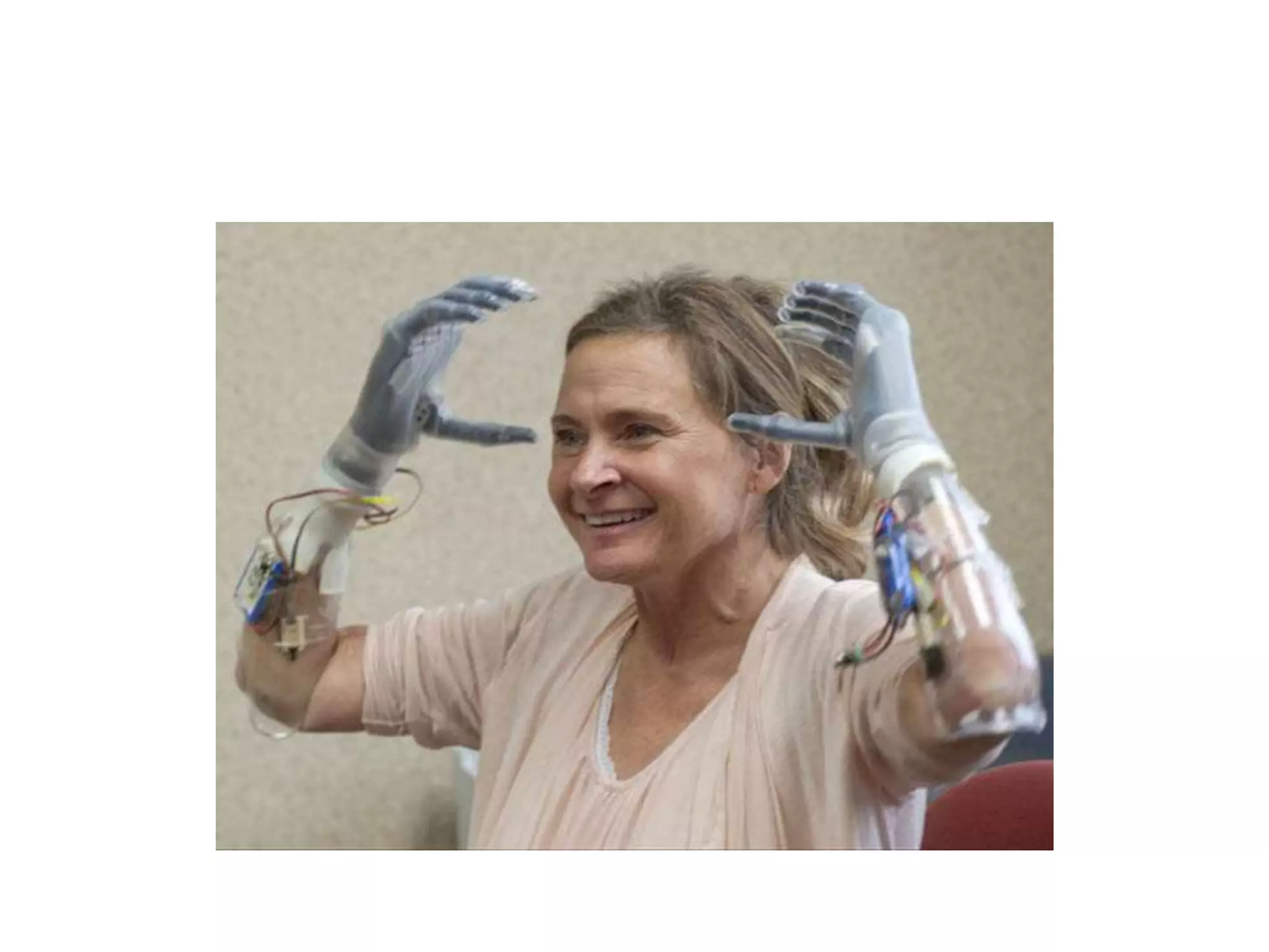 Lower limb prosthesis | PPTX