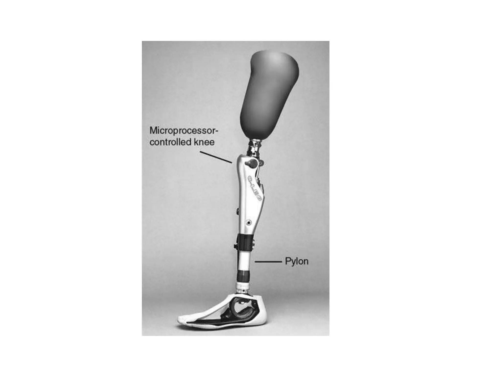 Lower limb prosthesis | PPTX