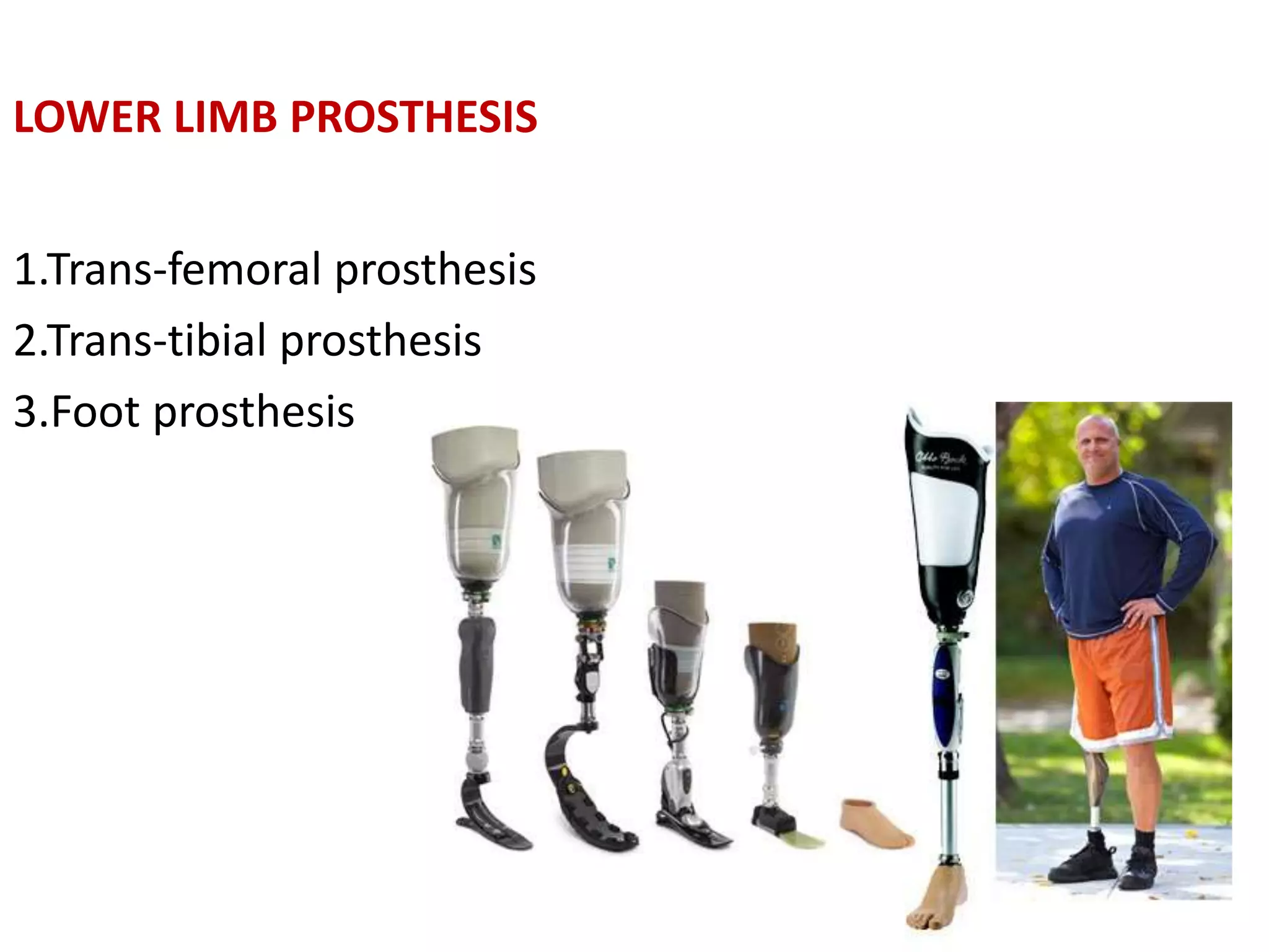 Lower limb prosthesis | PPTX