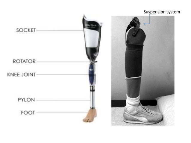 Lower Limb Prosthesis Pptx