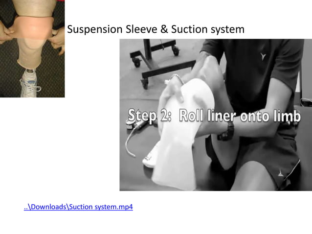 Lower limb prosthesis | PPTX