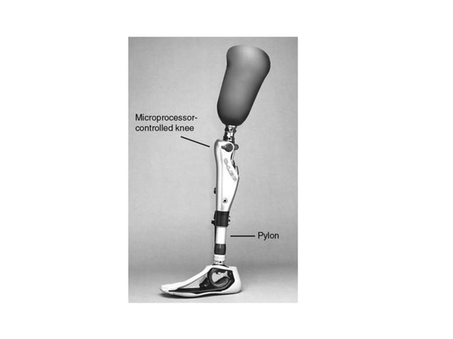Lower limb prosthesis | PPTX