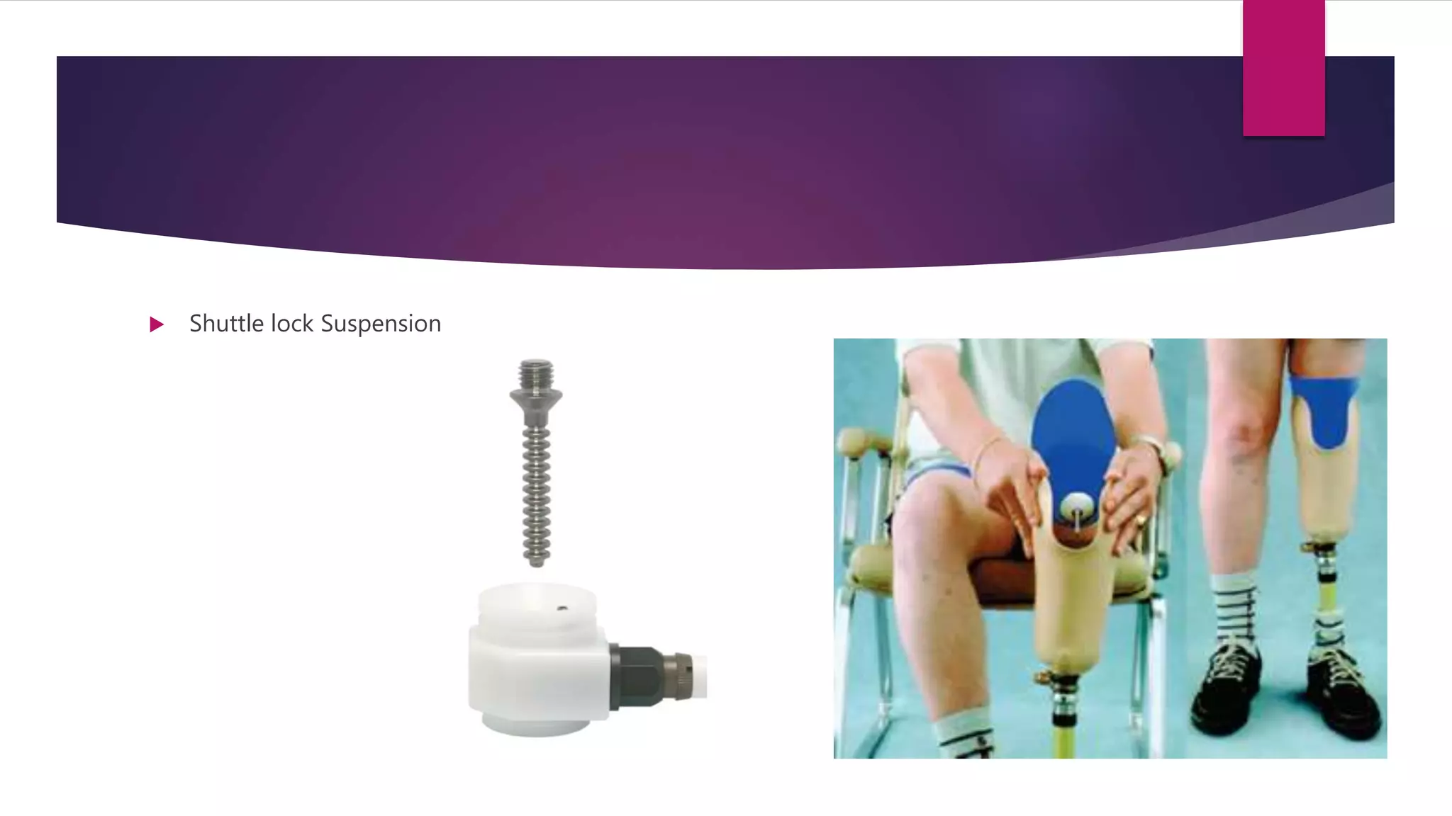 Lower limb prosthesis (hip, knee) | PPTX