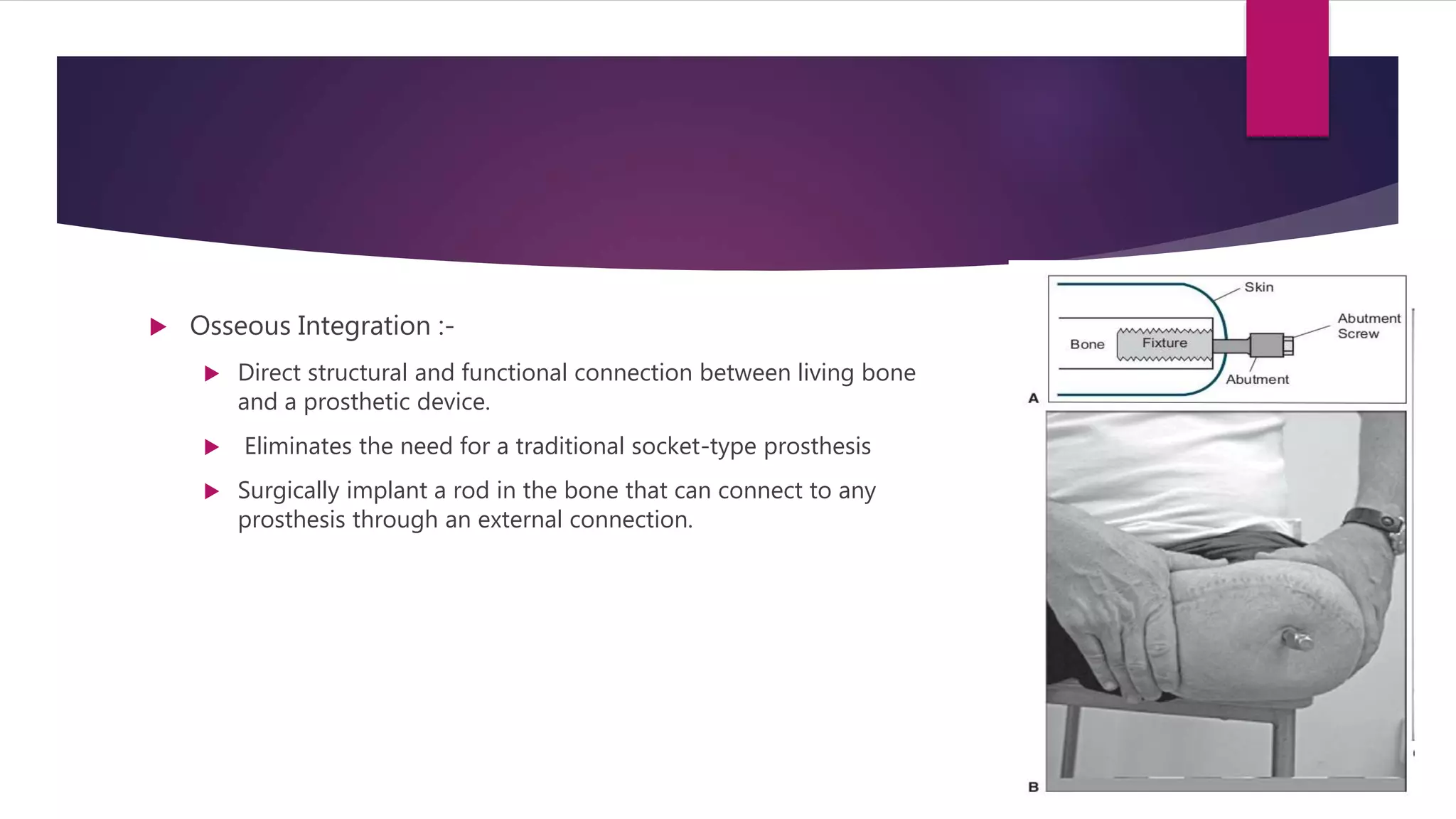 Lower limb prosthesis (hip, knee) | PPTX