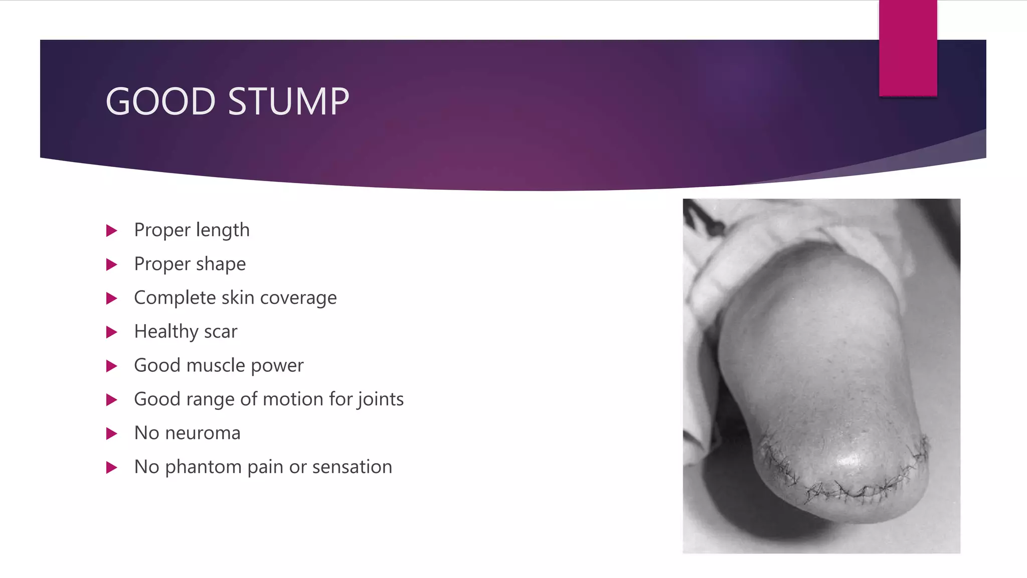 Lower limb prosthesis (hip, knee) | PPTX