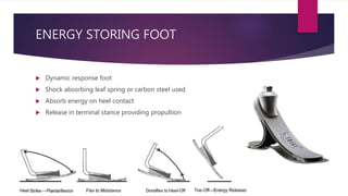 Lower limb prosthesis (hip, knee) | PPTX