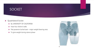 Lower limb prosthesis (hip, knee) | PPTX