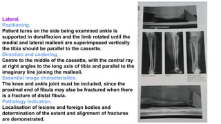 Lower limb radiography clarls positing.pptx