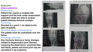 Lower limb radiography clarls positing.pptx