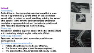 Lower limb radiography clarls positing.pptx