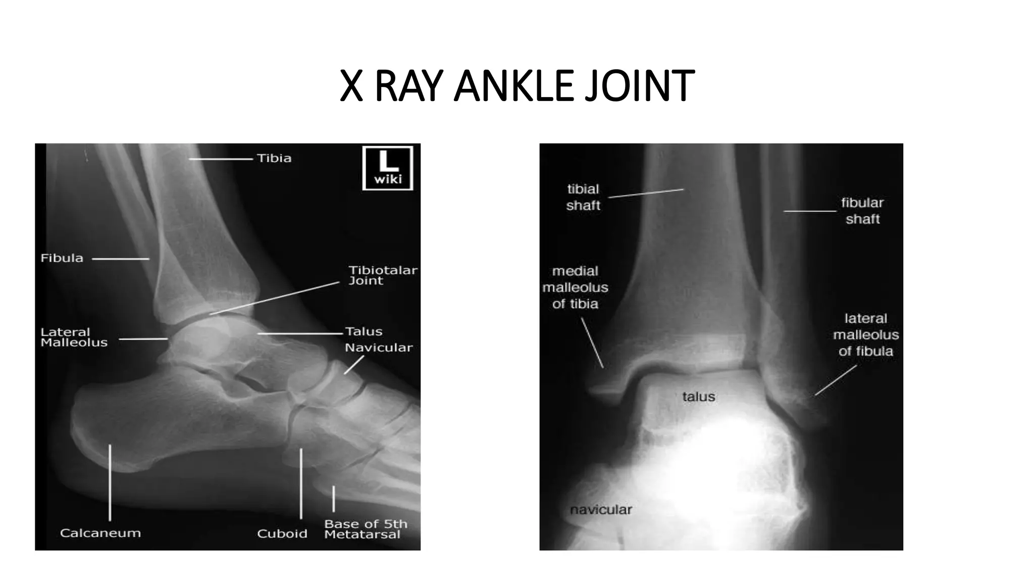 Lower limb radiology | PPTX