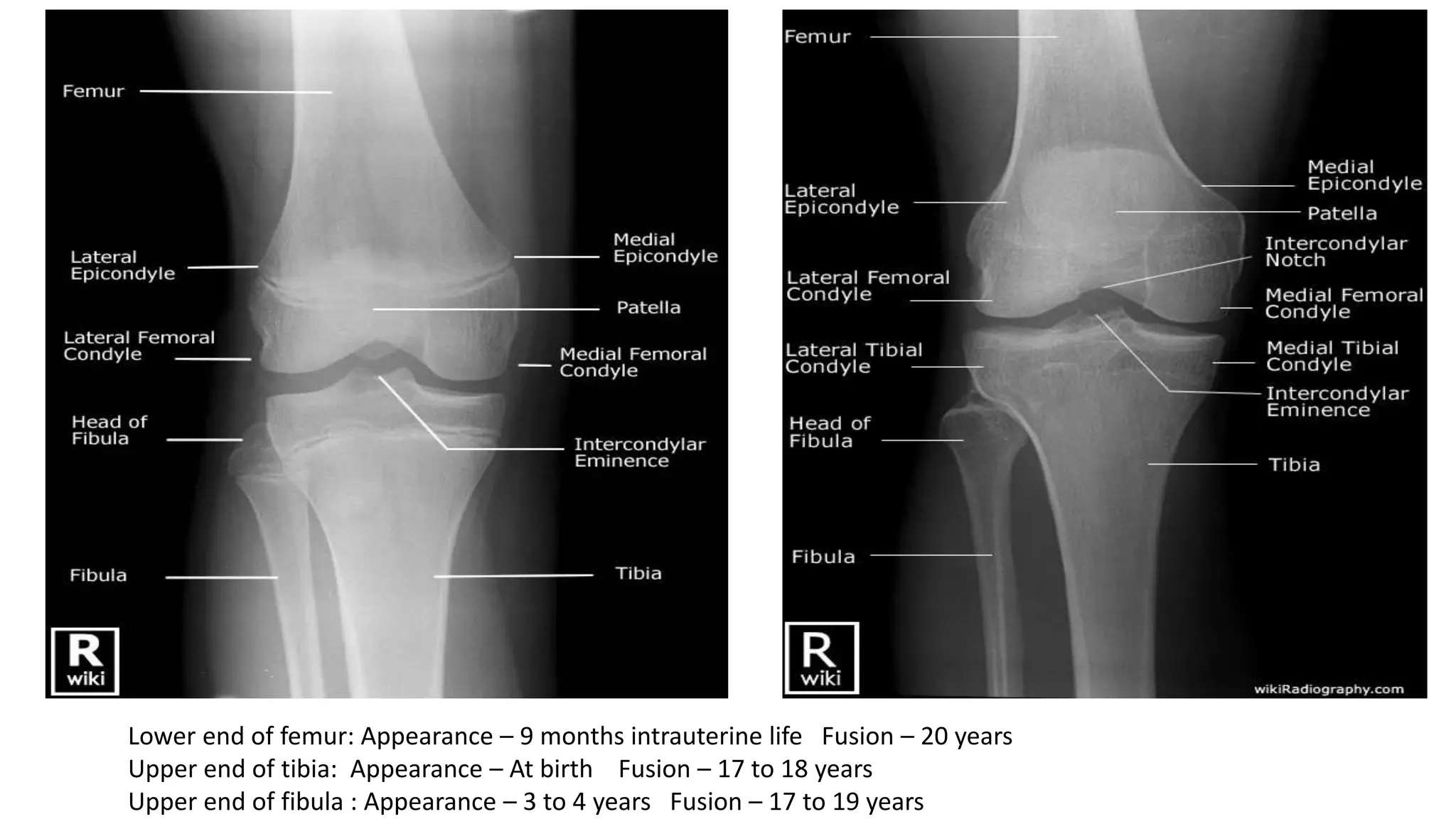 Lower limb radiology | PPTX