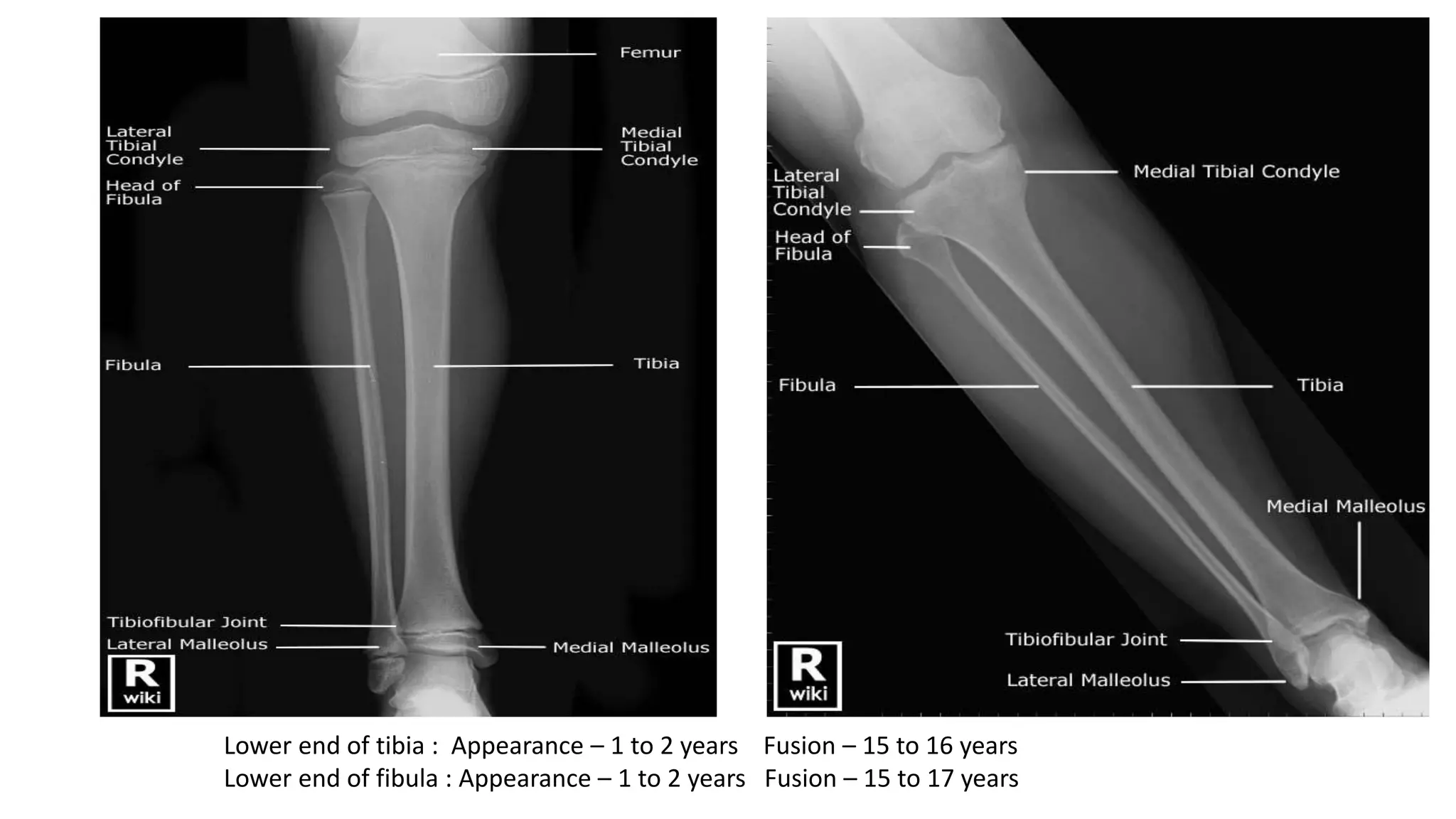 Lower limb radiology | PPTX