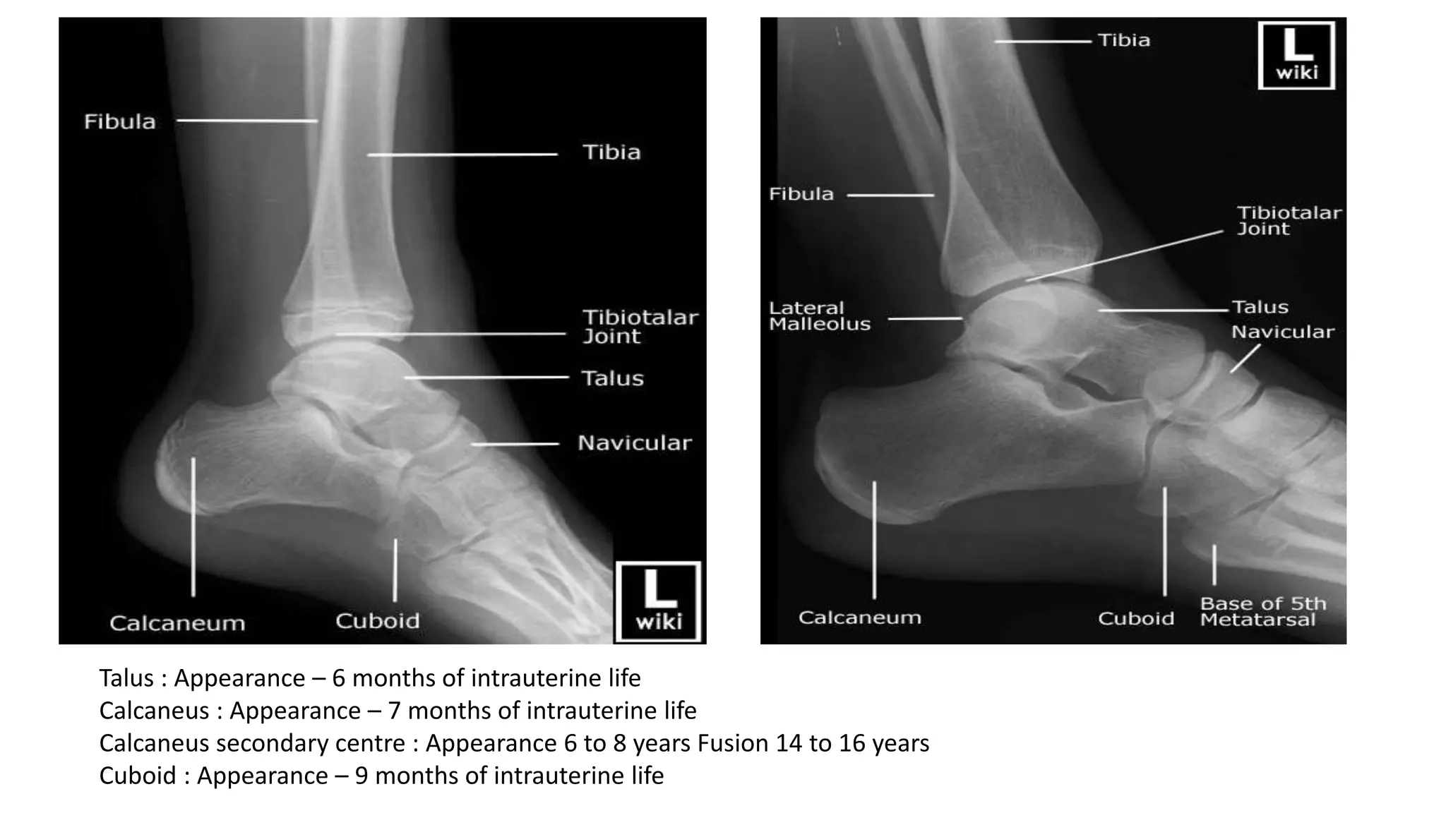 Lower limb radiology | PPTX