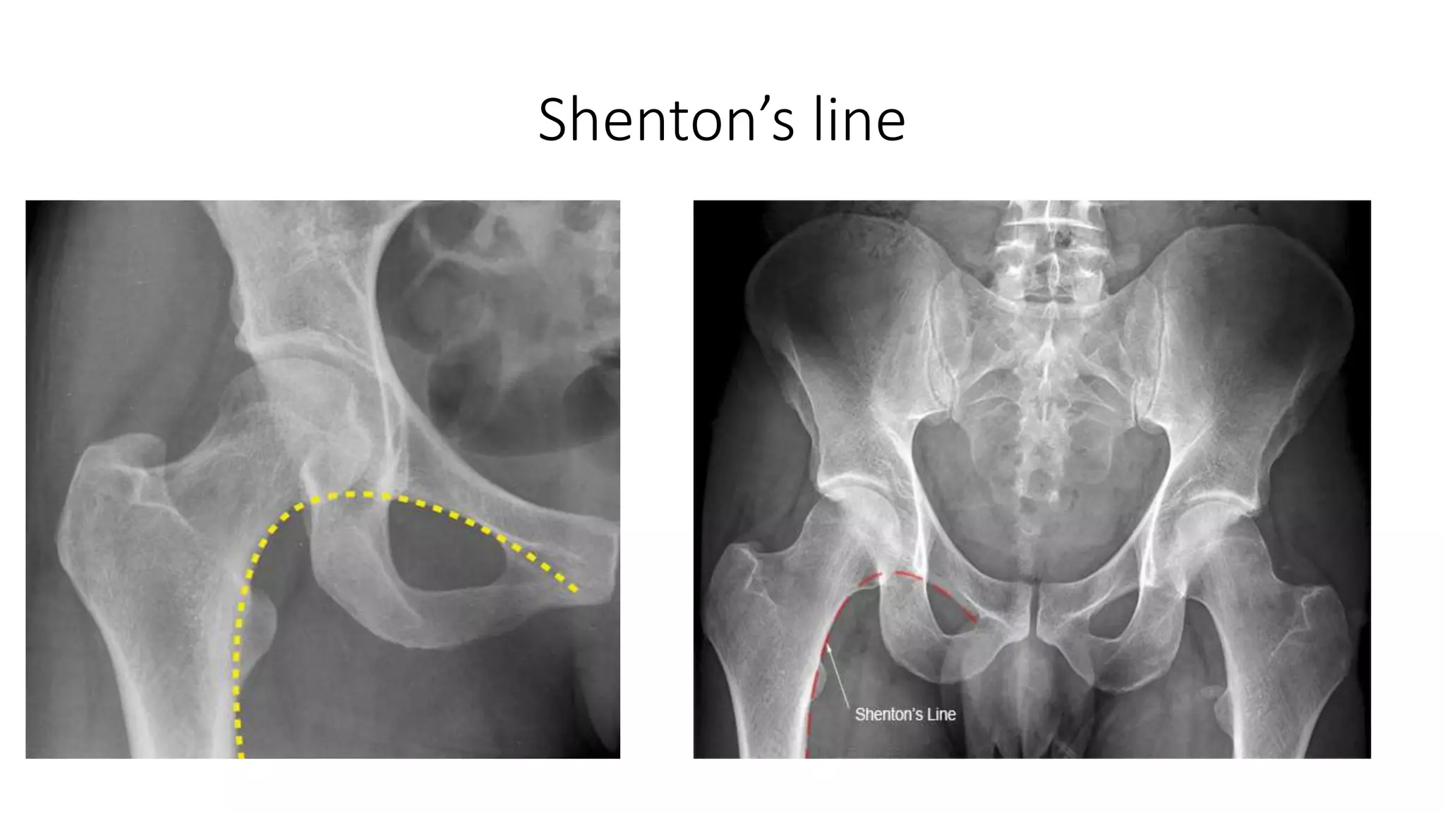 Lower limb radiology | PPTX