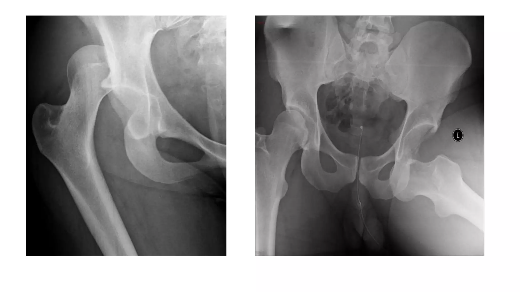 Lower limb radiology | PPTX