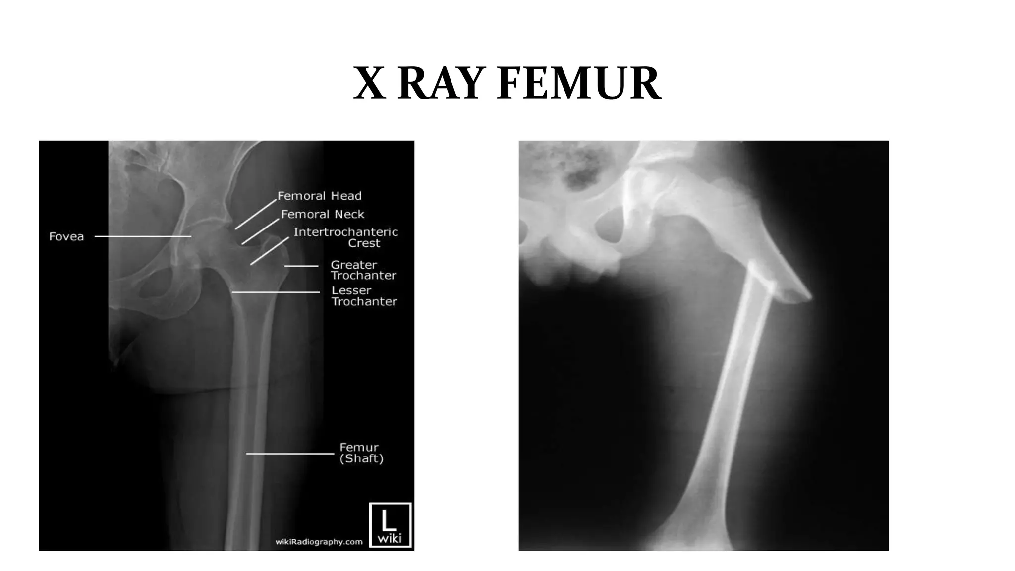 Lower limb radiology | PPTX
