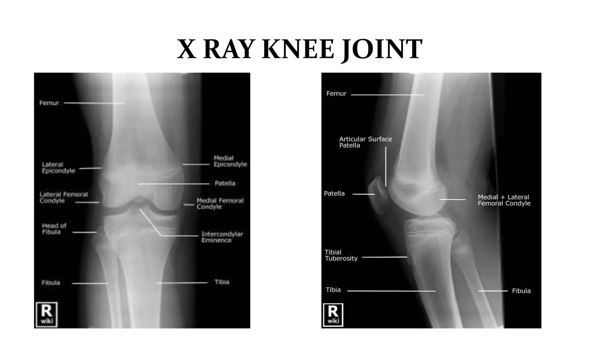 Lower limb radiology | PPTX