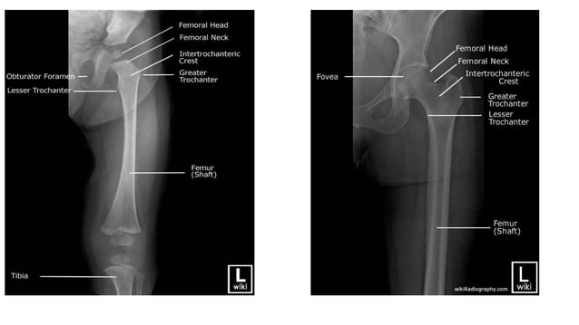 Lower limb radiology | PPT